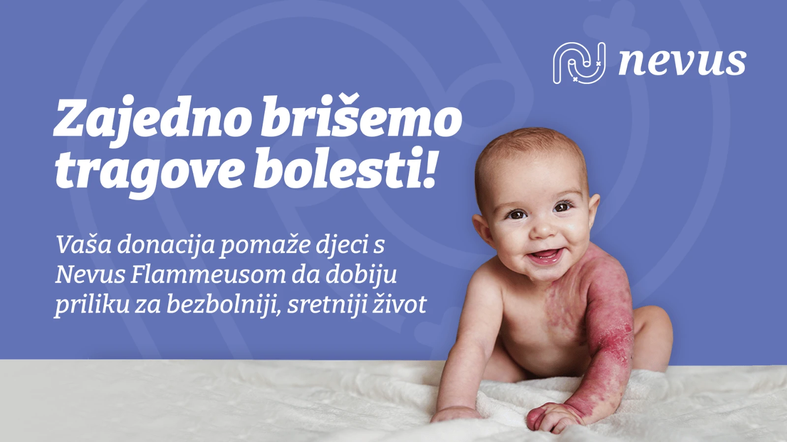 Nevus Flammeus: Priče roditelja i iskustva - Zadar TV